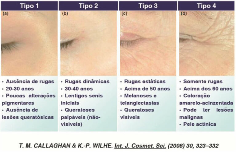 Sinais do envelhecimento: saiba como reverter com tratamentos estéticos.